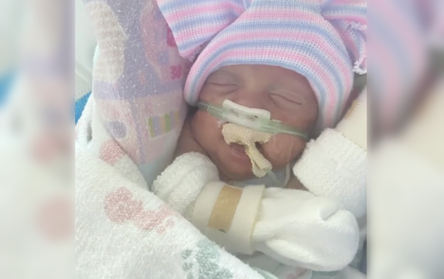 "I believe she is the smallest baby ever to be born, with this ...